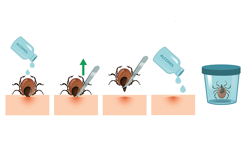 Boala Lyme (Borelioza): Ghid complet | Reginamaria.ro