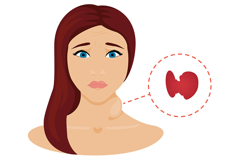 Hipertiroidism: cauze | Reginamaria.ro