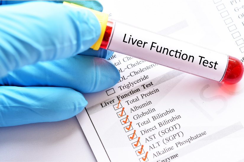 Analizele de ficat: ce spun despre sanatatea ta | Reginamaria.ro