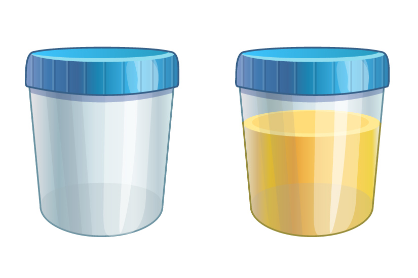 Colectarea urinei din 24 de ore | Regina Maria