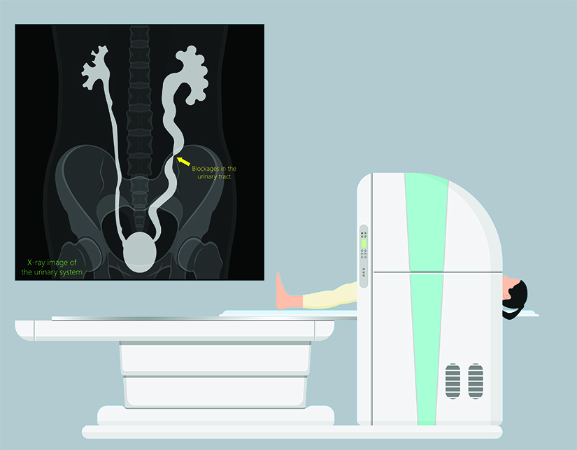 Examinarile Uro RMN si Uro CT, superioare urografiei clasice ...