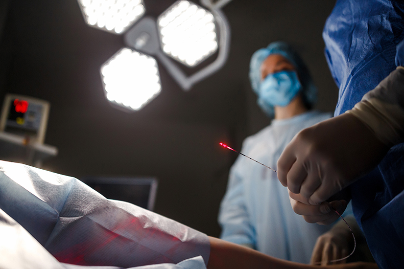 Tratamentul modern al varicelor cu laser | Reginamaria.ro