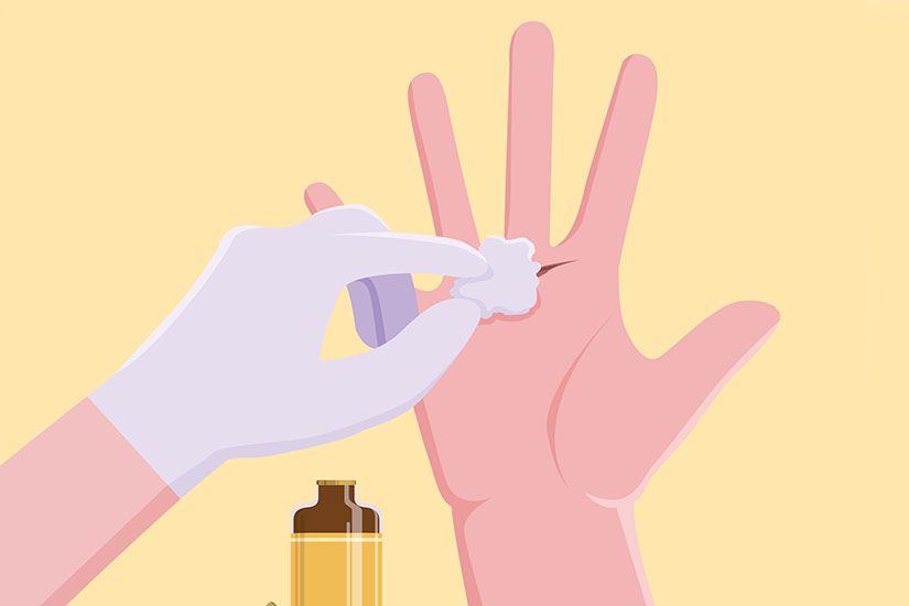 Primul ajutor: taieturi | Reginamaria.ro