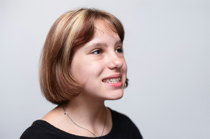 Qu'est-ce qu'une malocclusion Comment corriger une morsure tordue À ...