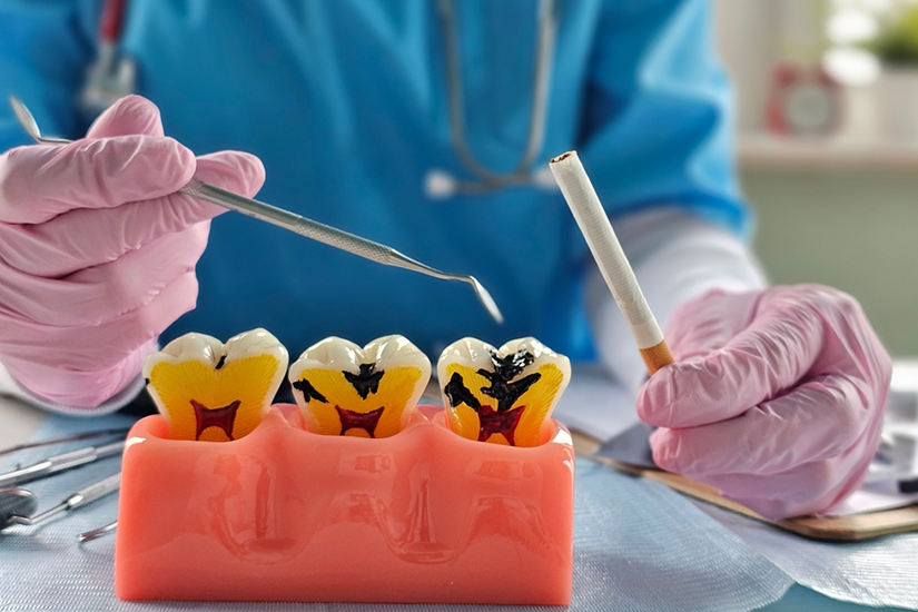 Efectele fumatului asupra sanatatii dintilor | Reginamaria.ro